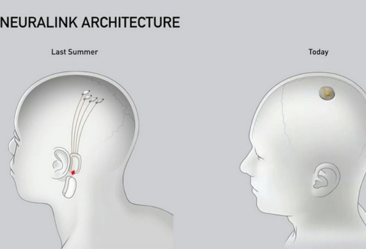 Perigos e possíveis efeitos adversos do Neuralink - Revolução Etc
